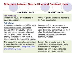Peptic ulcer. | PPTX