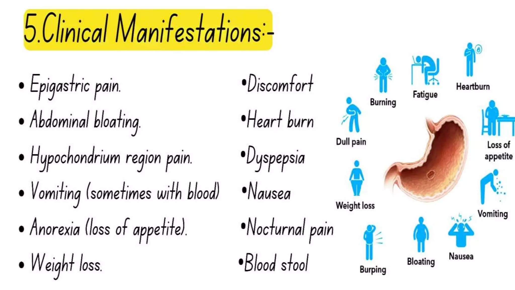 PEPTIC ULCER SLIDESHARE | PPTX