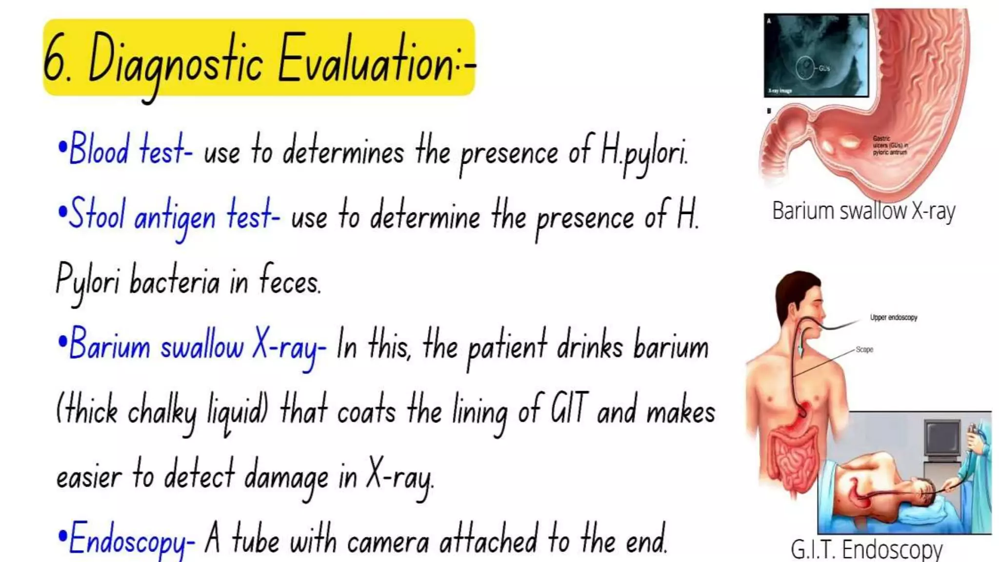 PEPTIC ULCER SLIDESHARE | PPTX