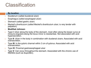 Peptic ulcer 1.pptx