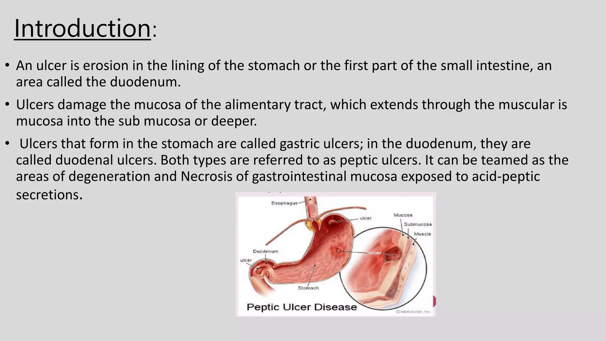 A study of gastrointestinal Diseas - Peptic Ulcer | PPT