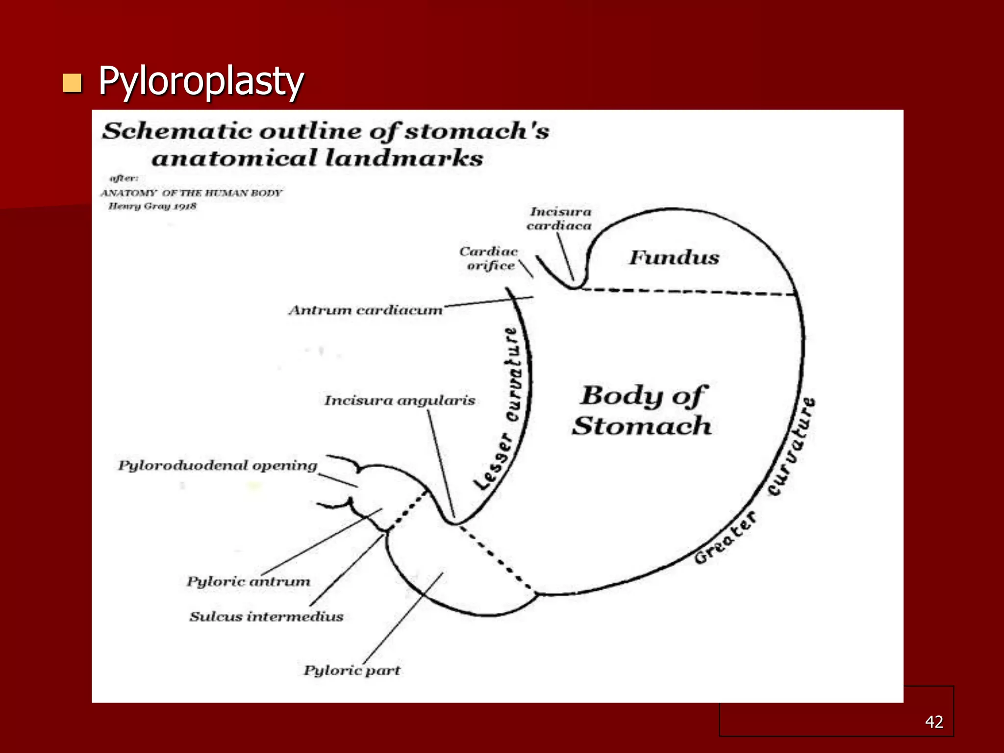 Peptic ulcer and duodenal ulcer ppt2 | PPT
