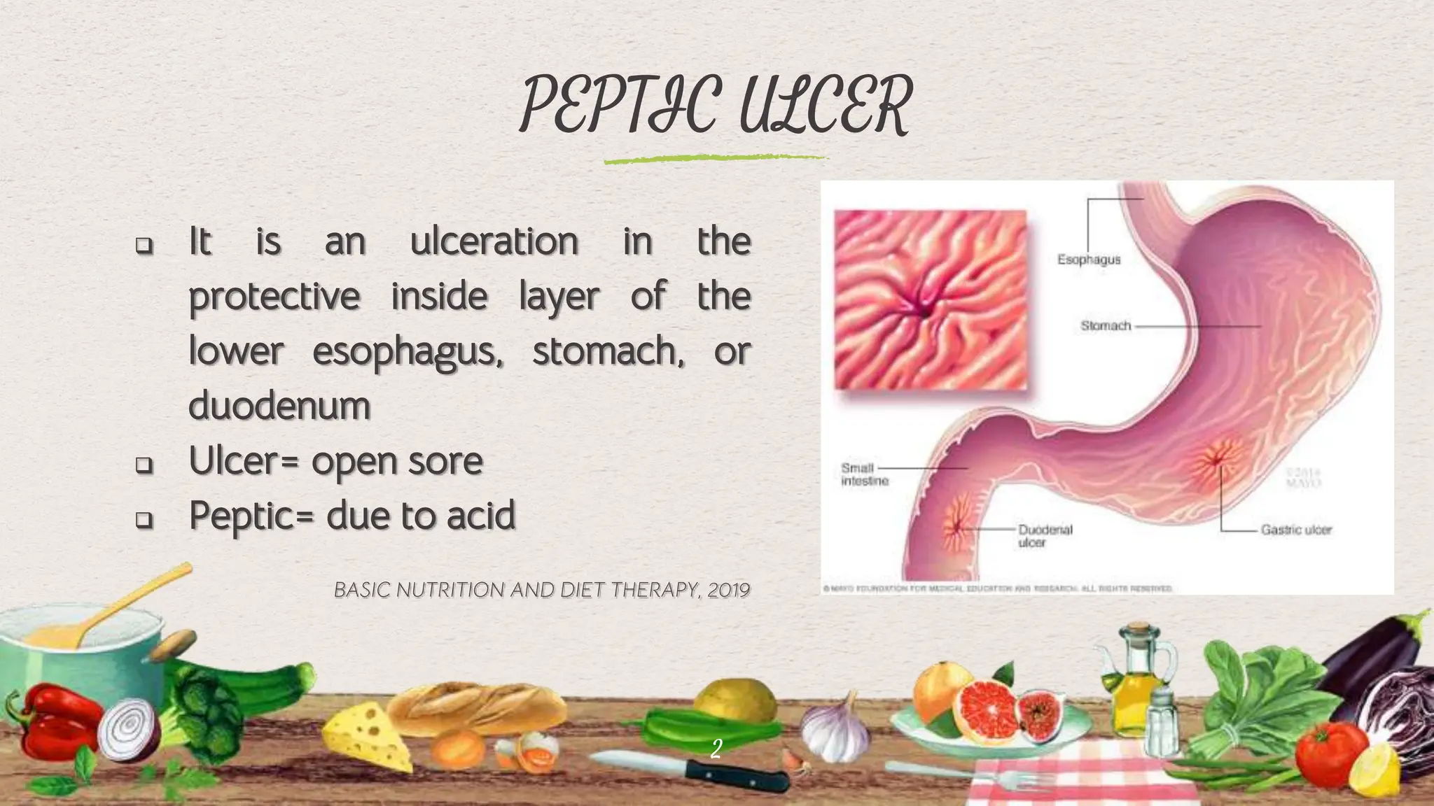 Dietary Management for Peptic Ulcer and GERD | PPTX