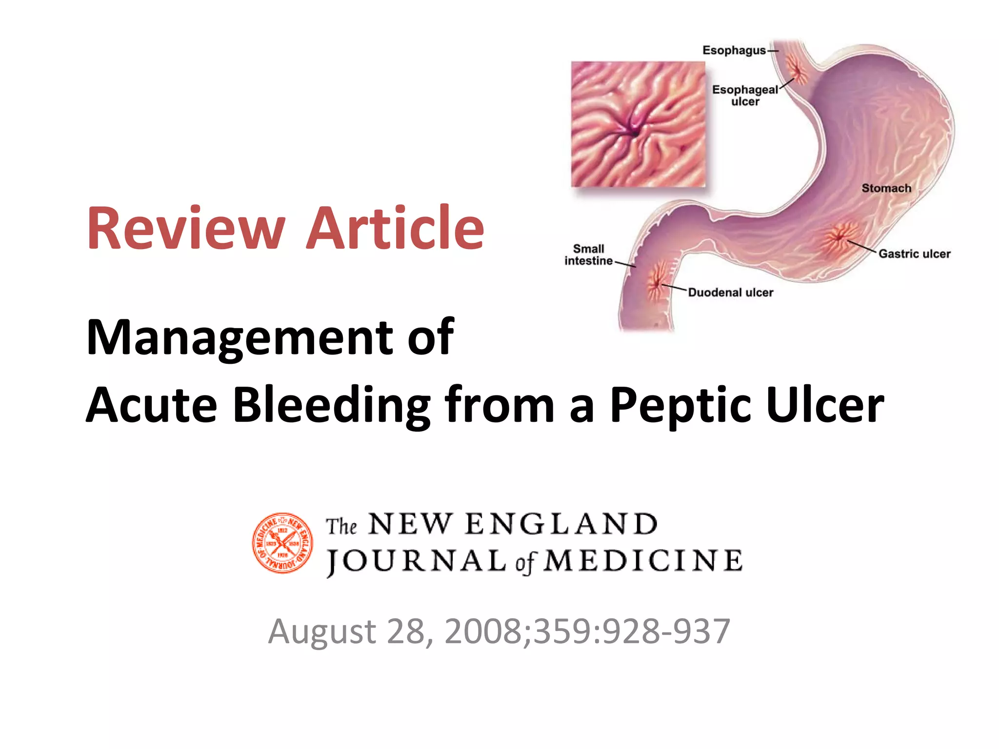 Peptic Ulcer Bleeding | PPT