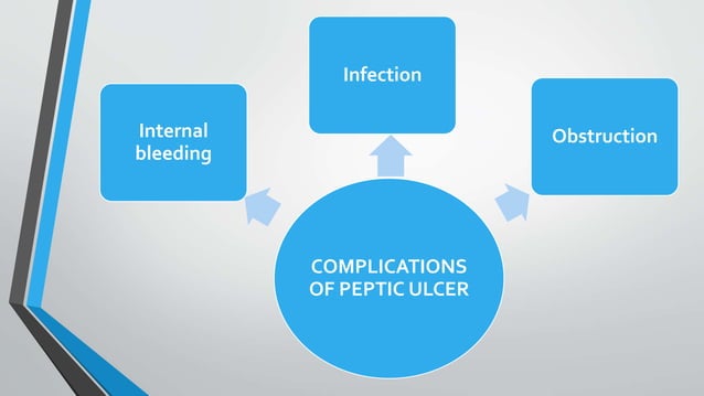 Peptic ulcer | PPTX