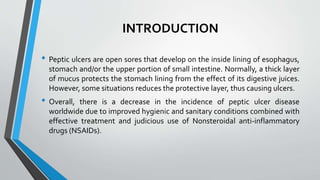Peptic ulcer | PPTX