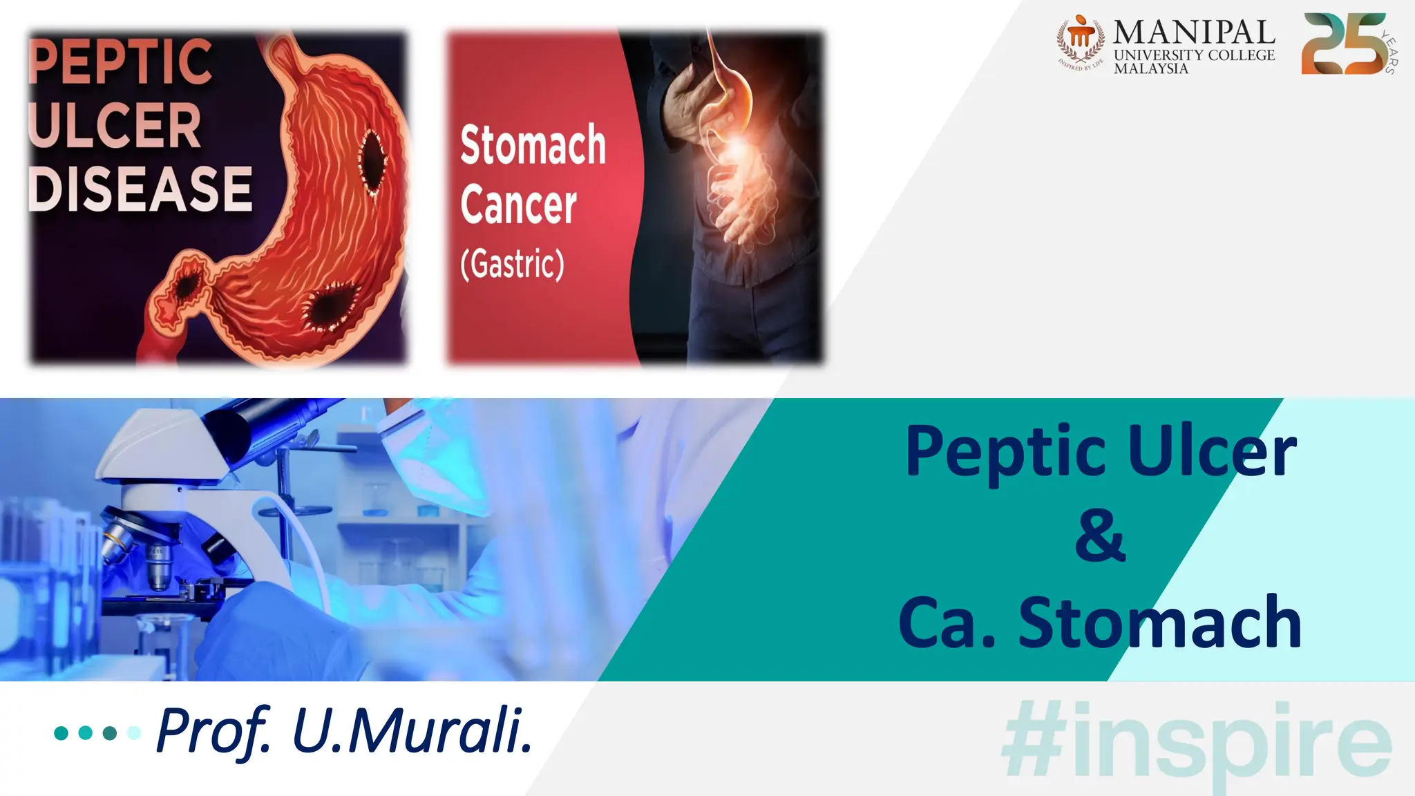 Peptic Ulcer Disease + Carcinoma Stomach. | PDF
