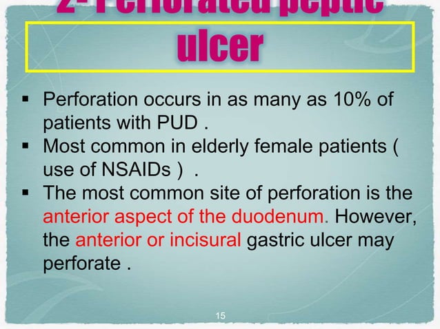Peptic ulcer complications | PPTX