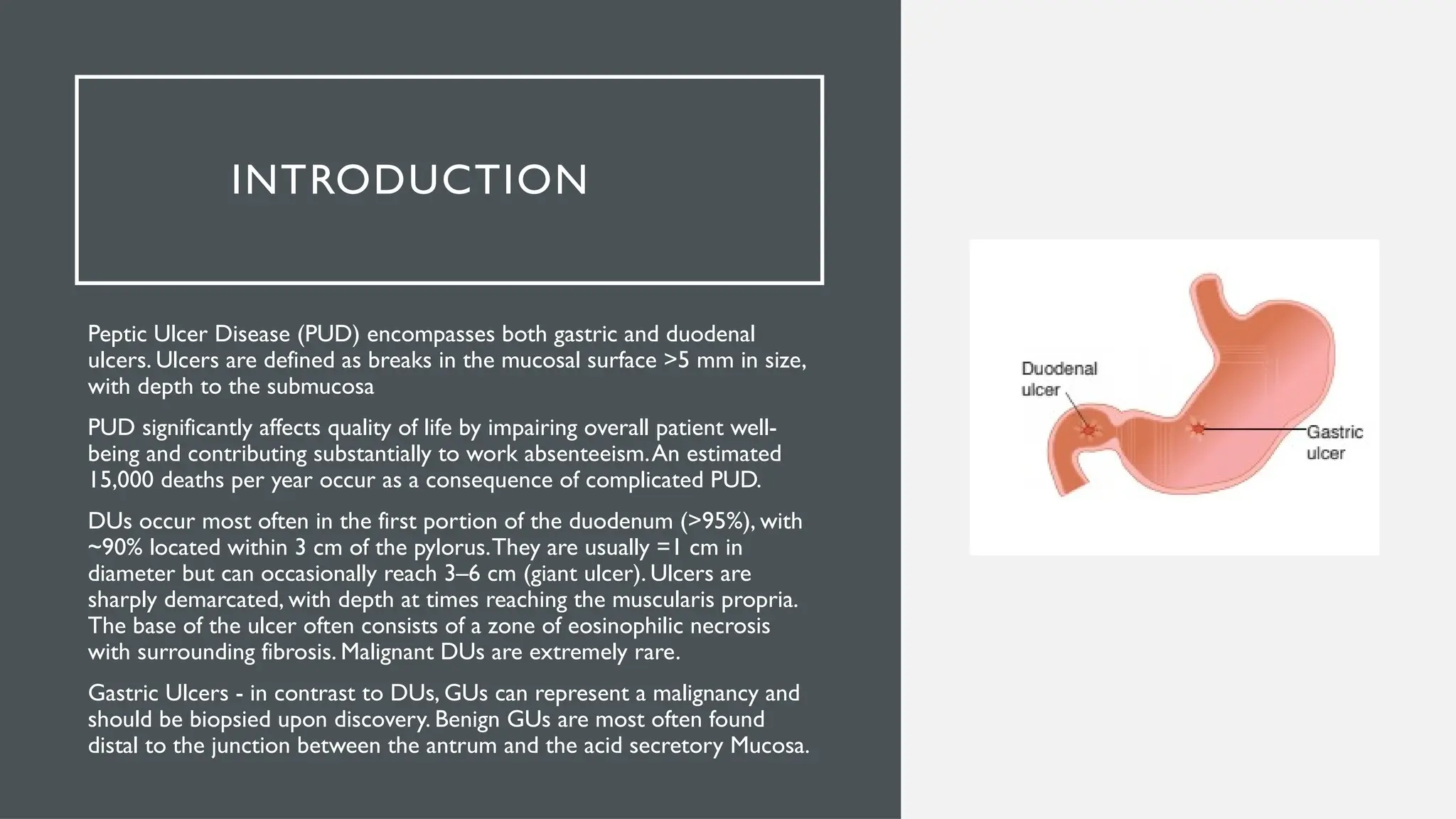 Peptic ulcer, diagnostics and management 1.pptx