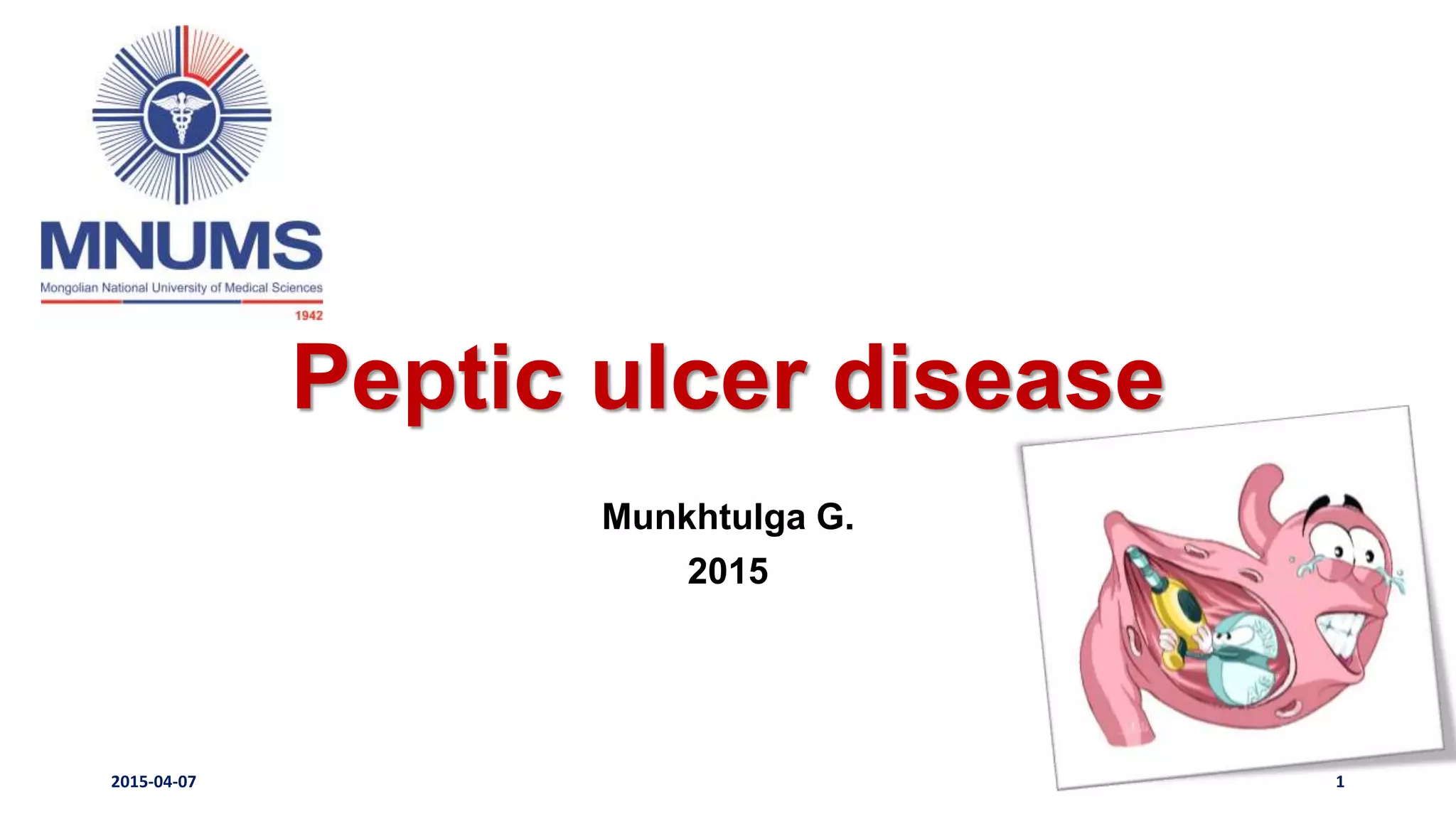 Peptic ulcer disease, upper gastrointestinal tract bleeding management ...