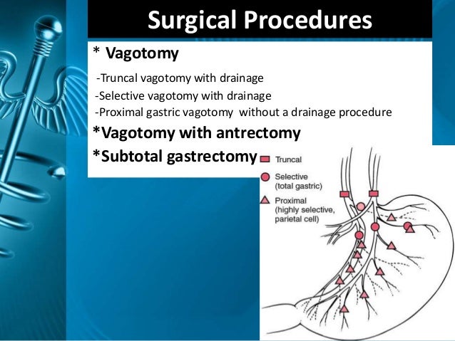 Peptic Ulcer Disease by Dr. Sookun Rajeev Kumar M.D