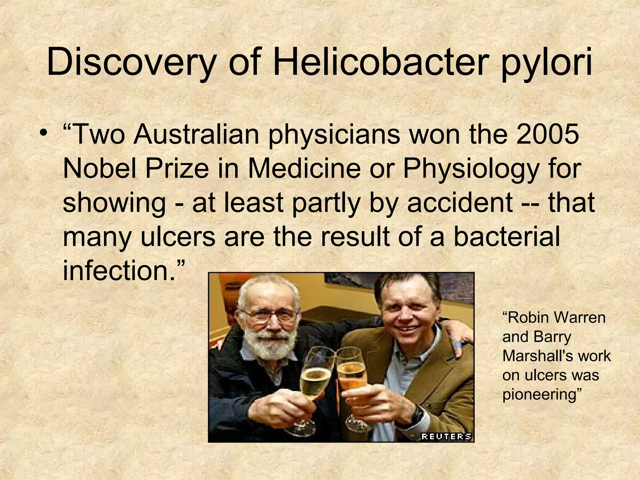 Peptic ulcer disease causes and treatment | PPT