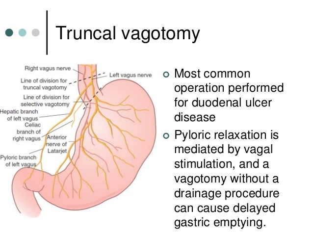 Peptic ulcer disease