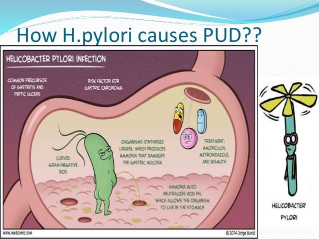 Peptic ulcer disease