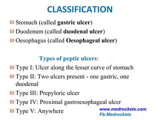 Peptic ulcer disease | PPT