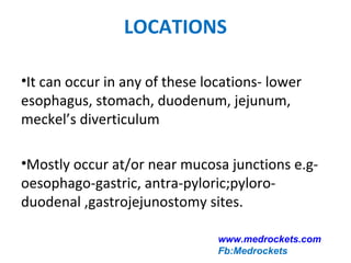 Peptic ulcer disease | PPT