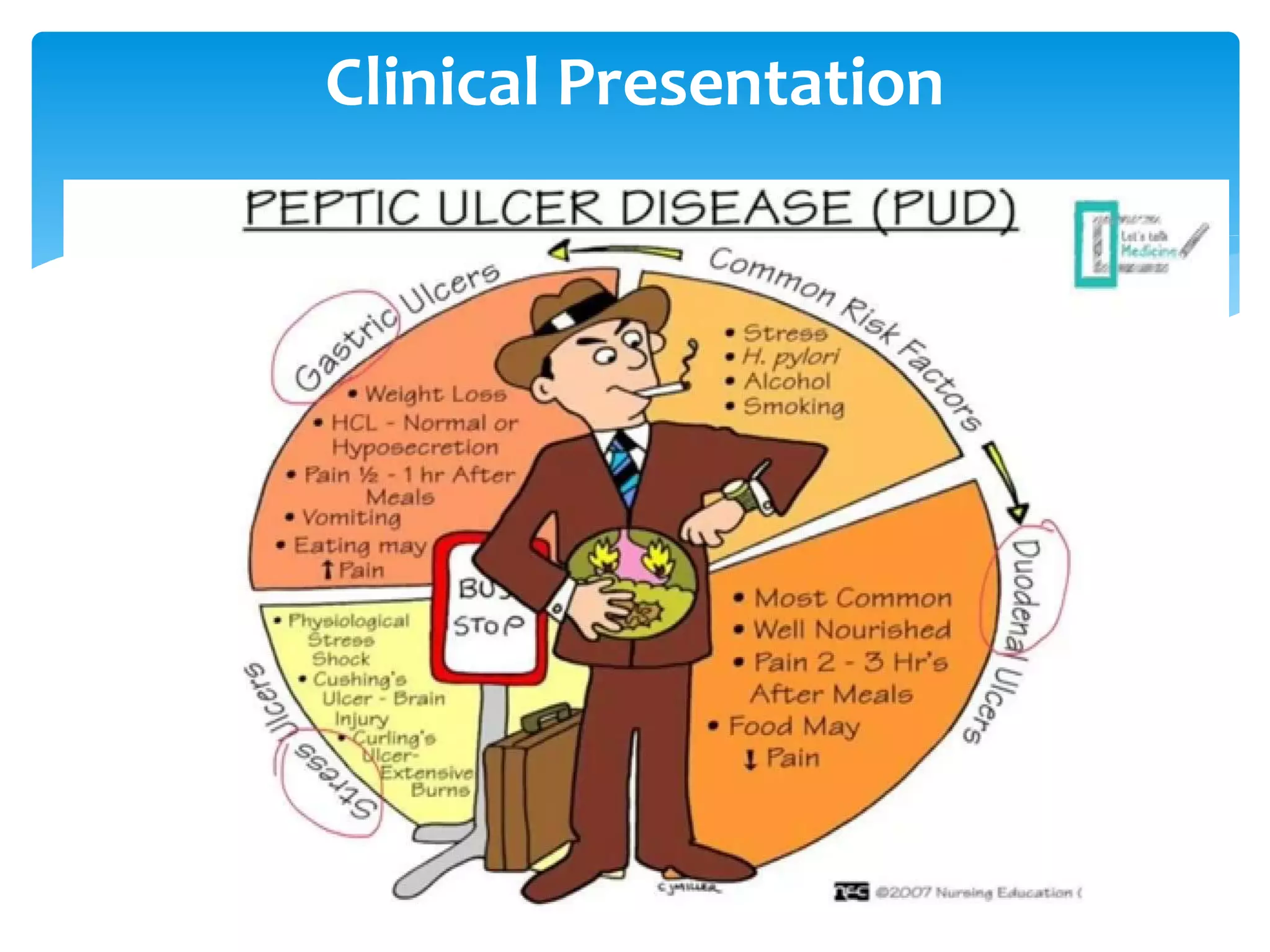 Peptic ulcer disease | PPTX