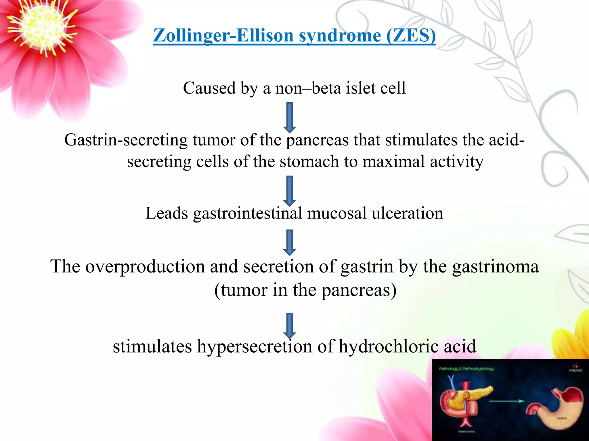 Peptic ulcer disease | PPTX