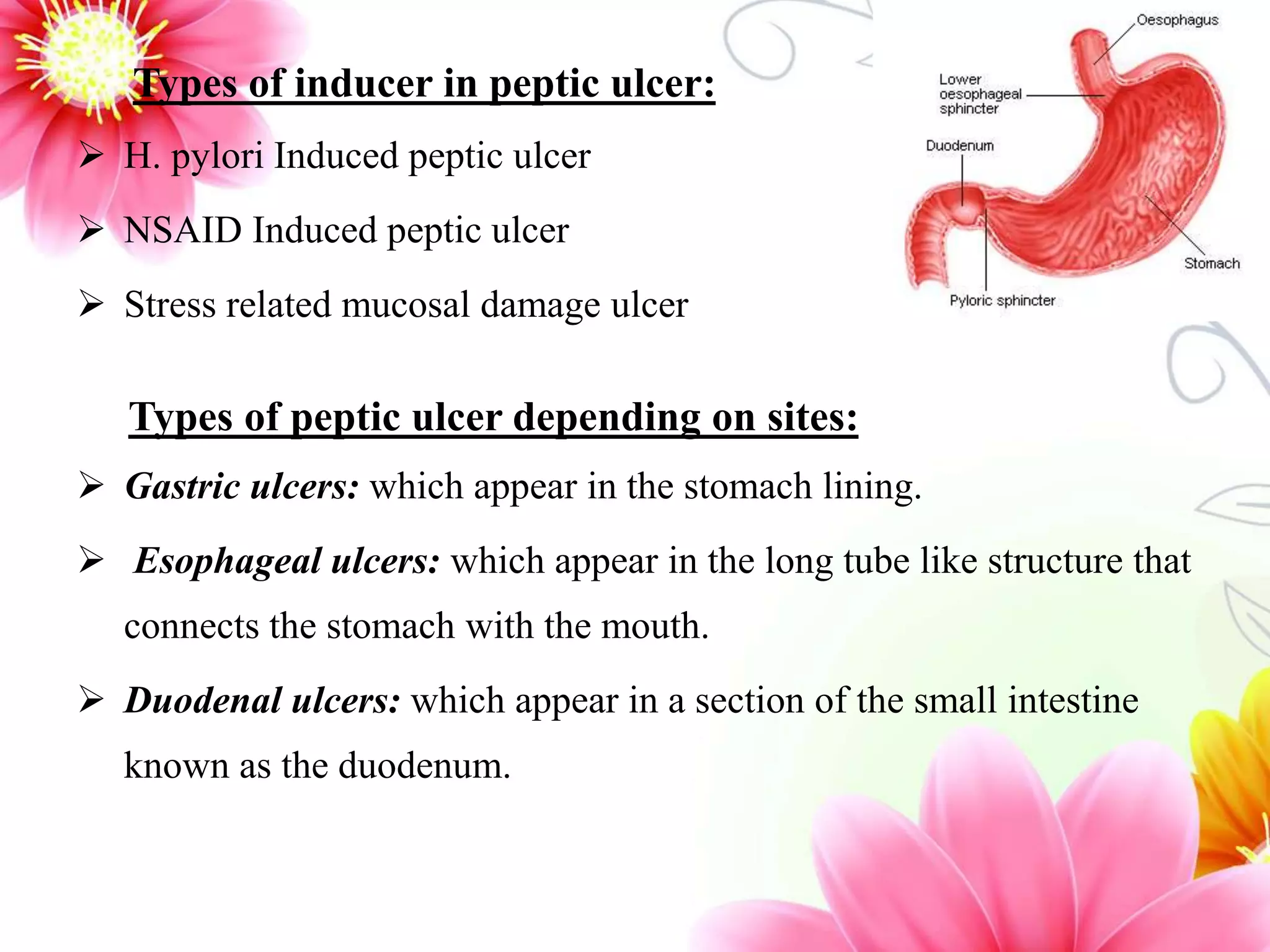 Peptic ulcer disease | PPTX