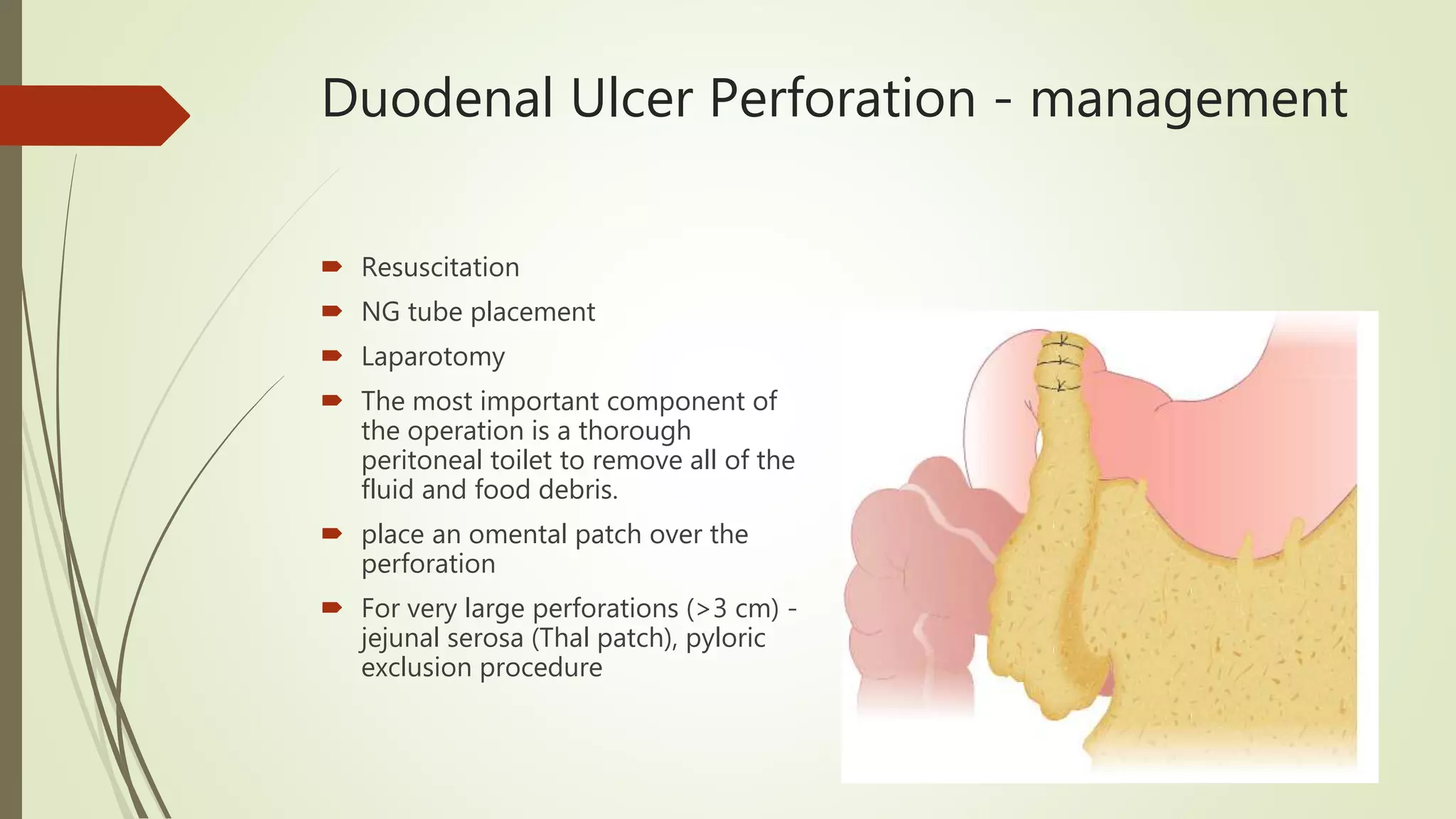 Peptic ulcer disease | PPTX