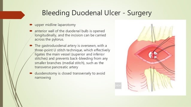 Peptic ulcer disease