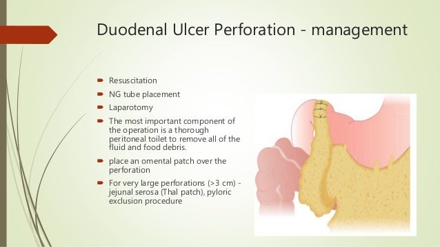 Peptic ulcer disease