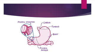 Peptic ulcer disease (PUD) | PDF