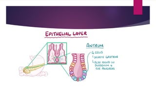 Peptic ulcer disease (PUD) | PDF