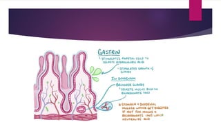 Peptic ulcer disease (PUD) | PDF