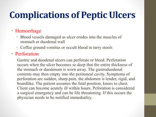 Peptic ulcer disease | PPT