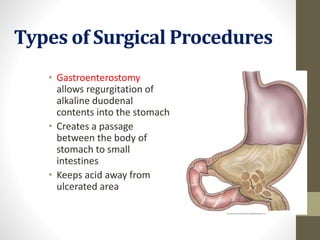 Peptic ulcer disease | PPT