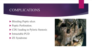 Peptic ulcer disease | PPTX