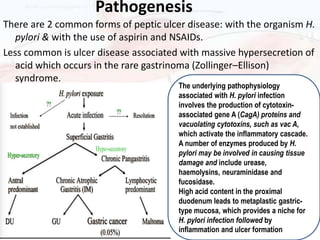 Peptic ulcer disease | PPTX