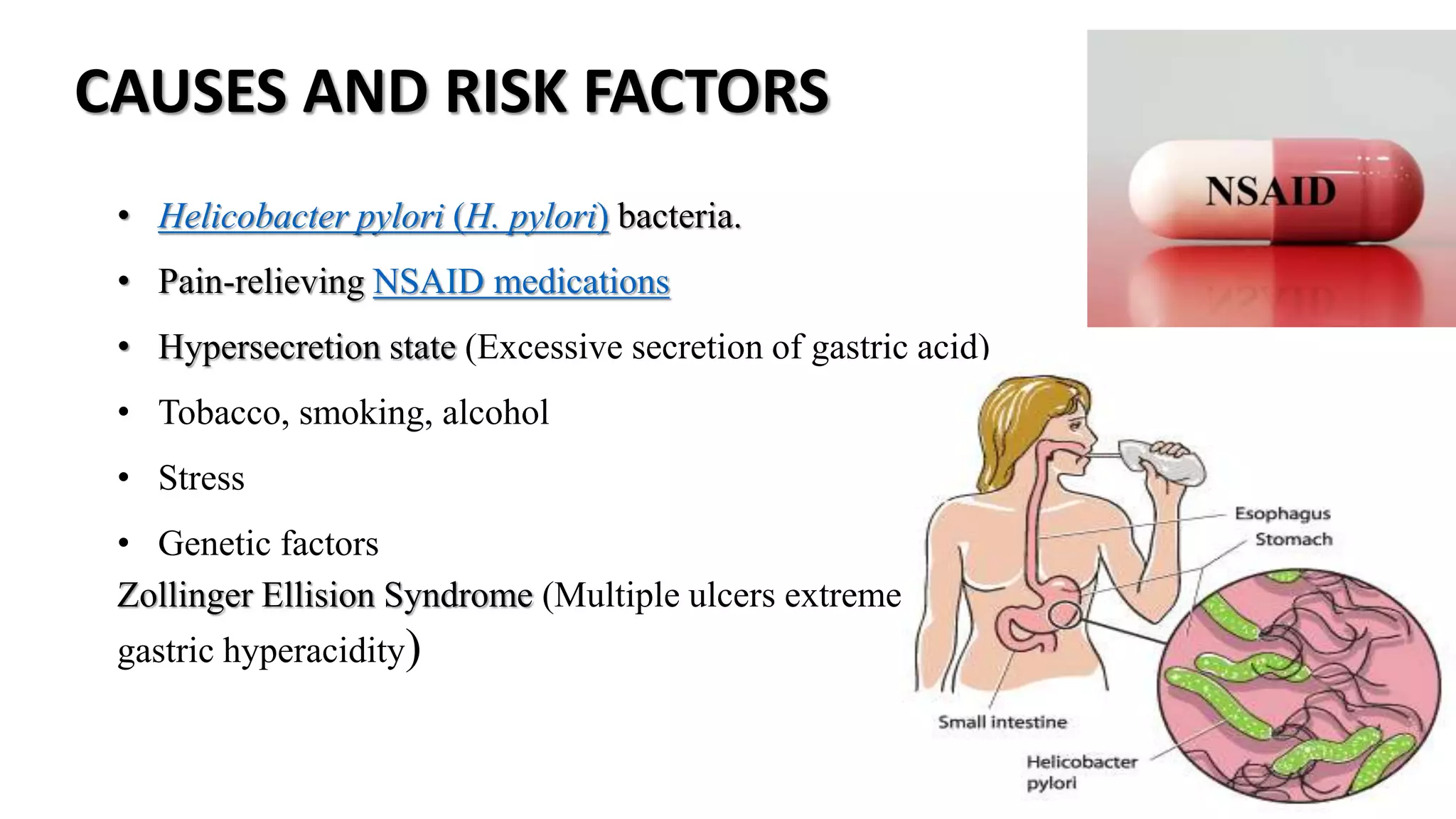 Peptic ulcer disease | PPTX