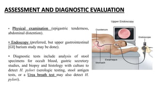 Peptic ulcer disease | PPTX