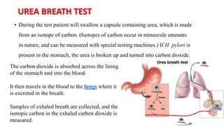Peptic ulcer disease | PPTX
