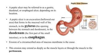 Peptic ulcer disease | PPTX