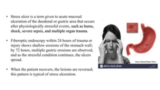 Peptic ulcer disease | PPTX