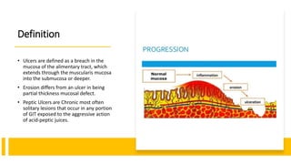 Peptic Ulcer Disease.pptx
