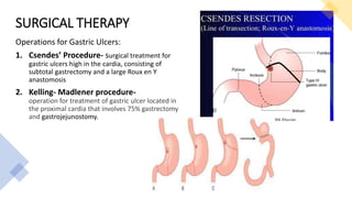Peptic Ulcer Disease.pptx
