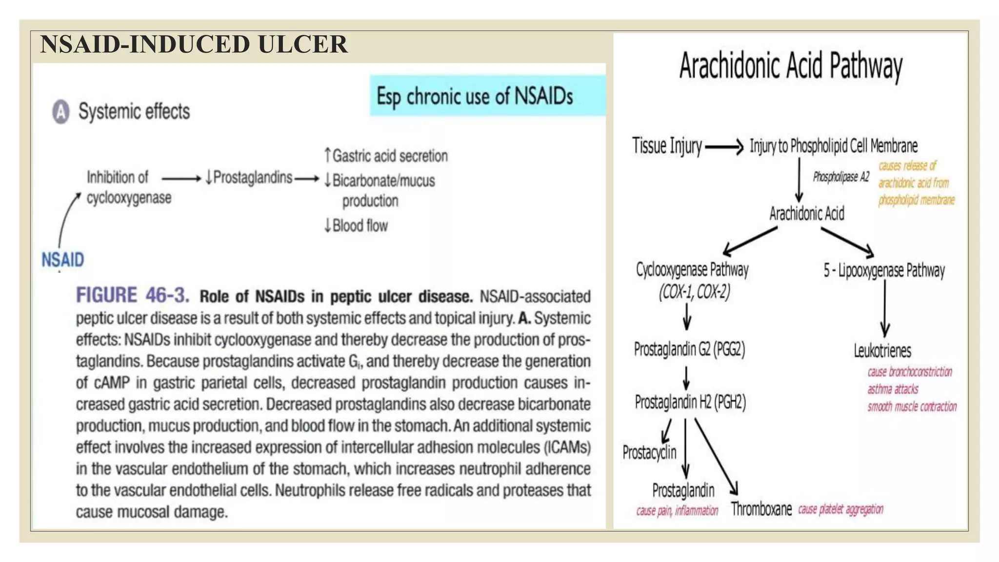 Peptic ulcer disease | PPTX