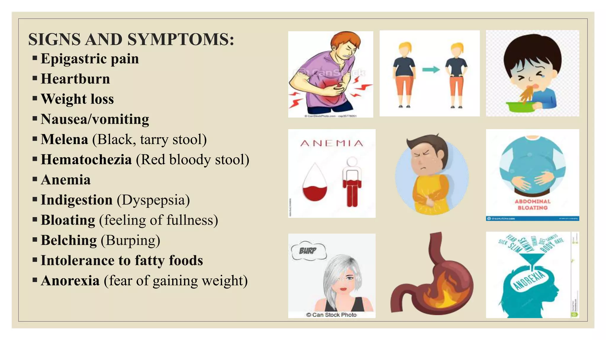 Peptic ulcer disease | PPTX