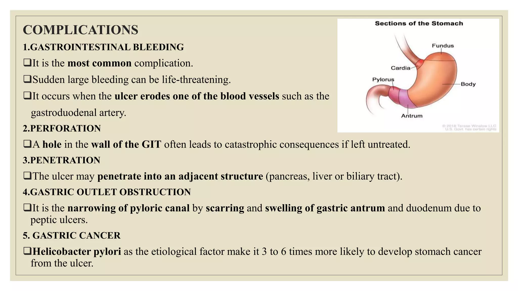 Peptic ulcer disease | PPTX