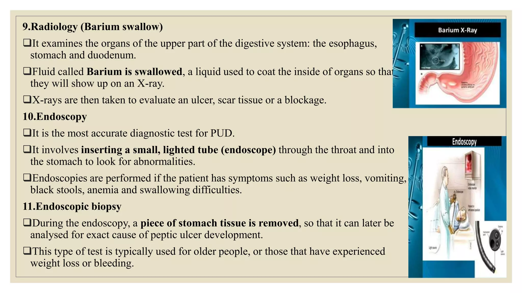 Peptic ulcer disease | PPTX