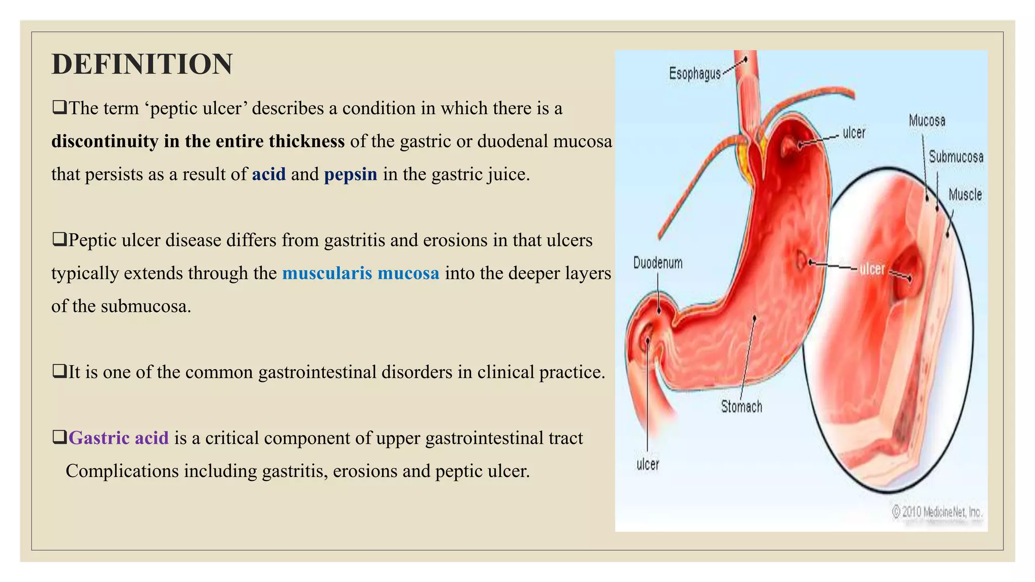 Peptic ulcer disease | PPTX