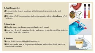 Peptic ulcer disease | PPTX