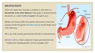 Peptic ulcer disease | PPTX