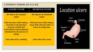 Peptic ulcer disease | PPTX