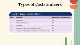 peptic ulcer disease.pptx