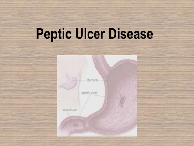 peptic_ulcer_disease.ppt